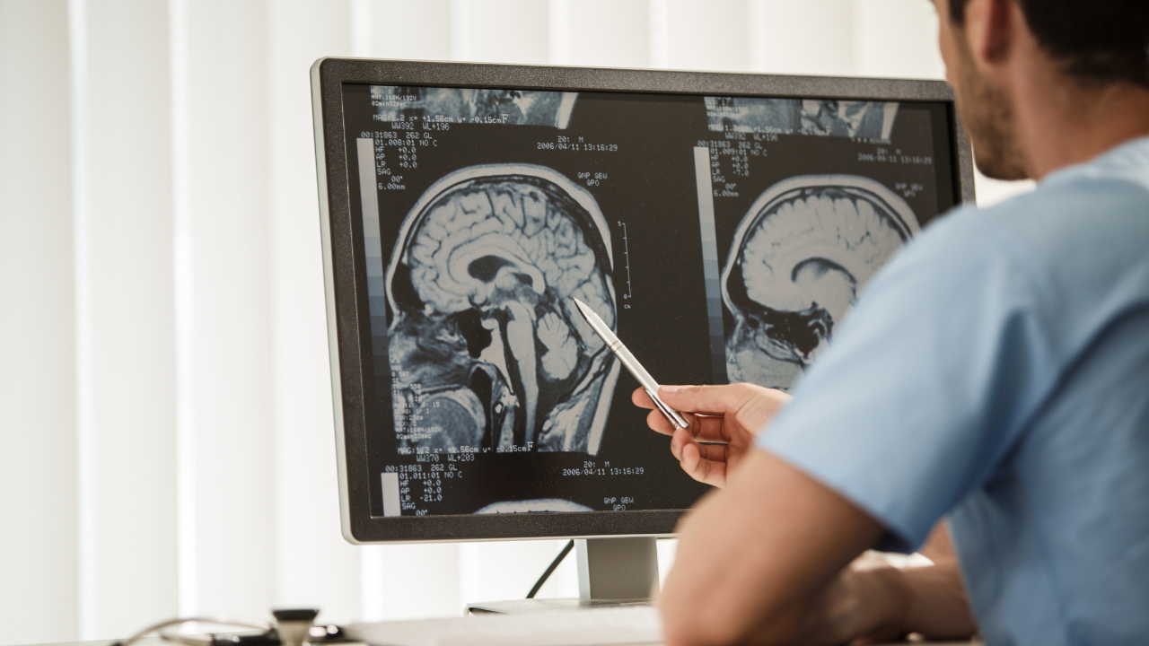 Why aggressive brain cancer is no longer a certain death sentence