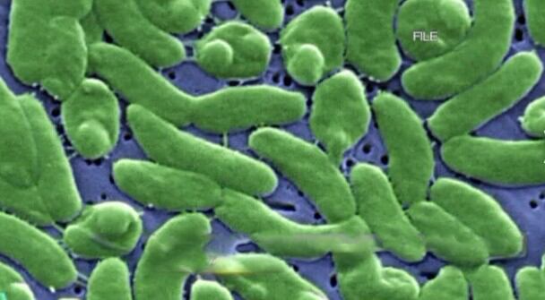 Florida teen fights 'flesh eating bacteria'