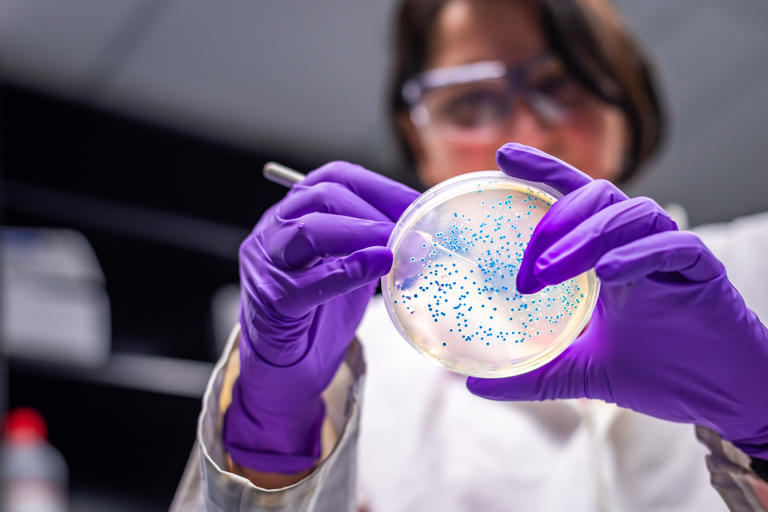 La «nebbia cerebrale» è più frequente tra chi soffre di intestino ...