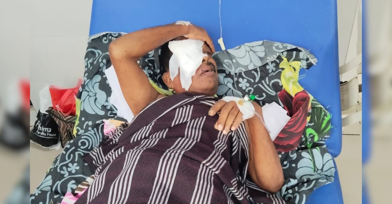 TVM man loses eyelid in stray dog attack; residents flag recurring threat