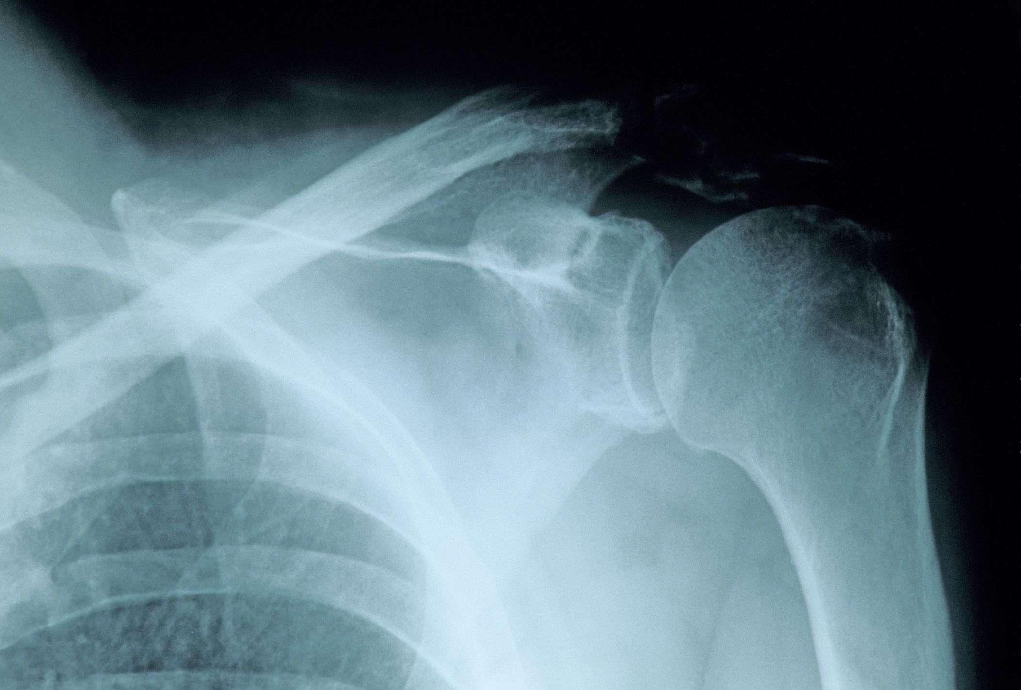 Calcium: wat is het en wat heb je er als fietser aan?