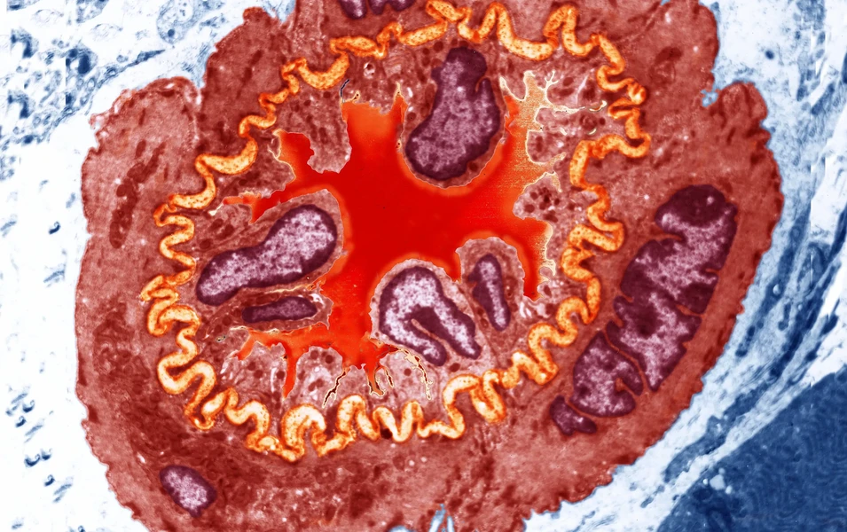 Plaque-targeting immunotherapy shows promise in preclinical heart studies