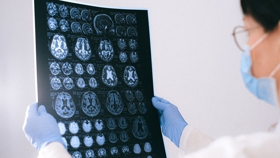 World Brain Tumour Day 2026: Doctors reveal 7 subtle brain tumour ...