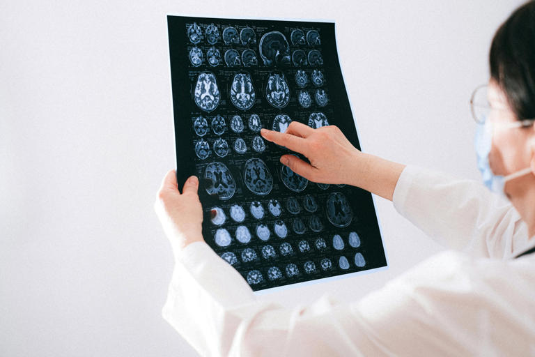 Neurologist says it’s not just a headache and shares early warning ...