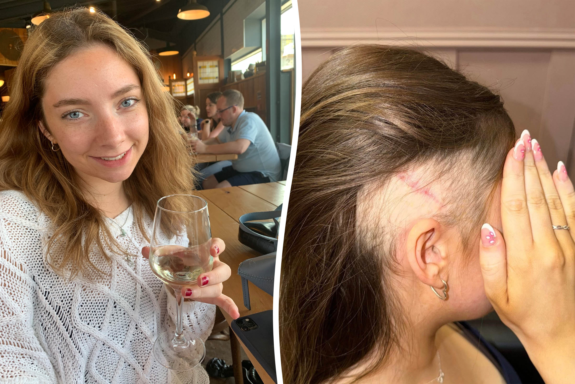 Student’s ‘exam stress’ headaches were actually brain tumour