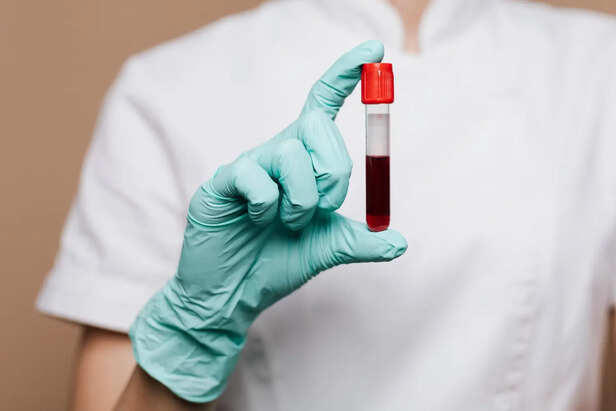Could a blood test predict cancer before symptoms appear?