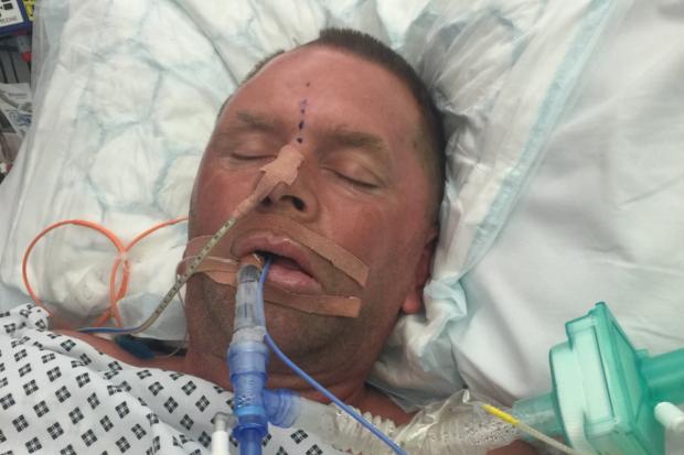 Man endures 3-month coma after head got trapped under truck while his ...