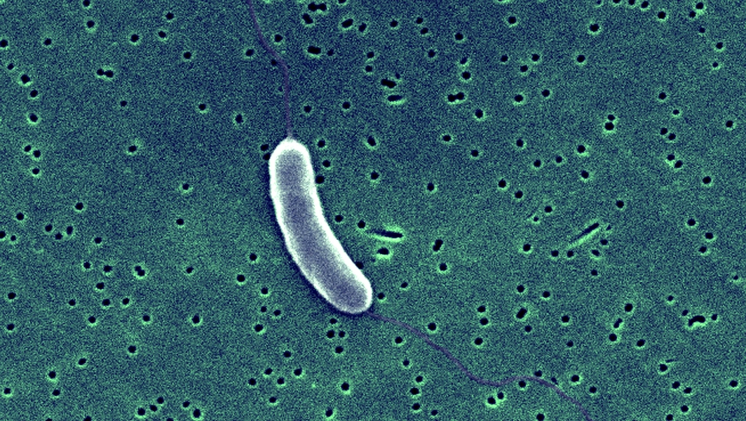 Florida teen battles rare Vibrio infection after park visit
