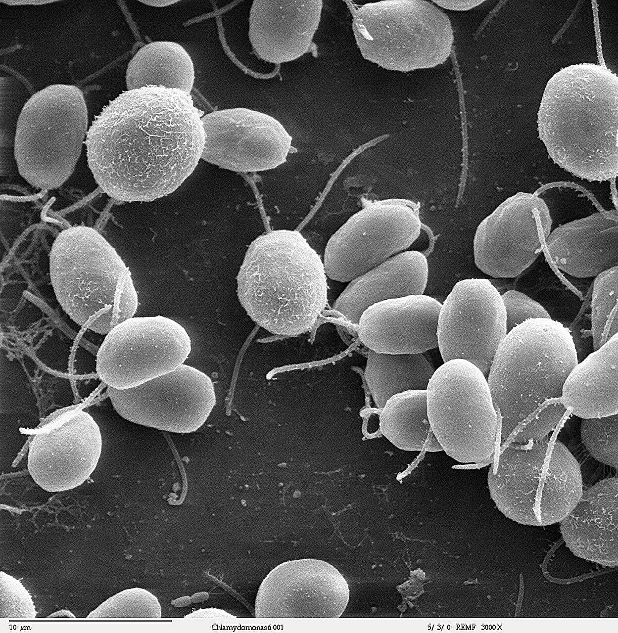 Hidden protein switch controls photosynthesis as light conditions change