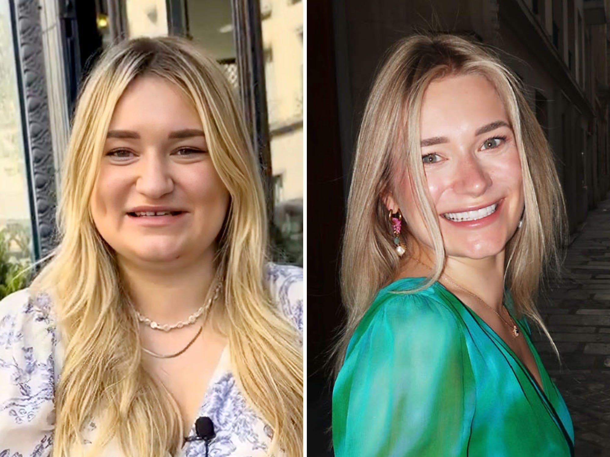After a break-up, I paid $20K for a glow-up at 28. People on social ...
