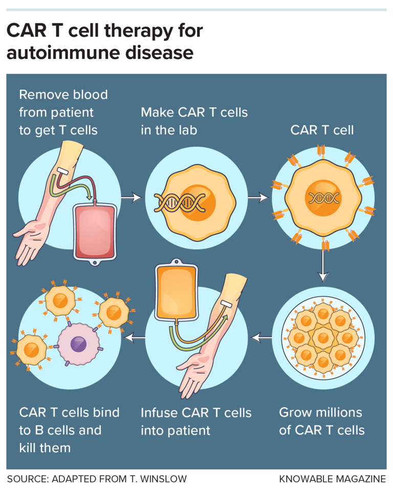 A revolutionary cancer treatment could transform autoimmune disease