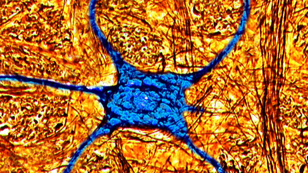 Scientists revise human brain neuron count to 86 billion