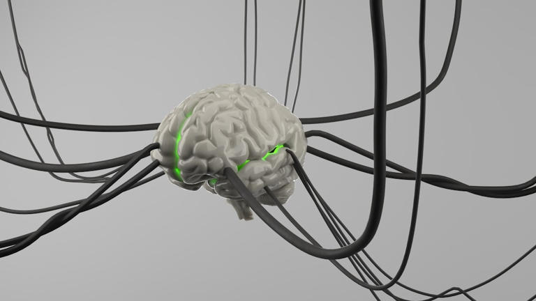 Neurologist says it’s not just a headache and shares early warning ...