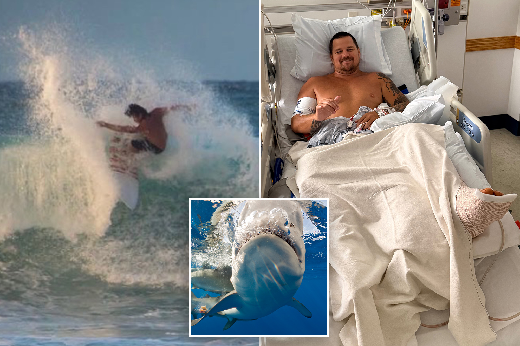Surfer describes how 8-foot shark ripped open his legs: 'My calf is ...