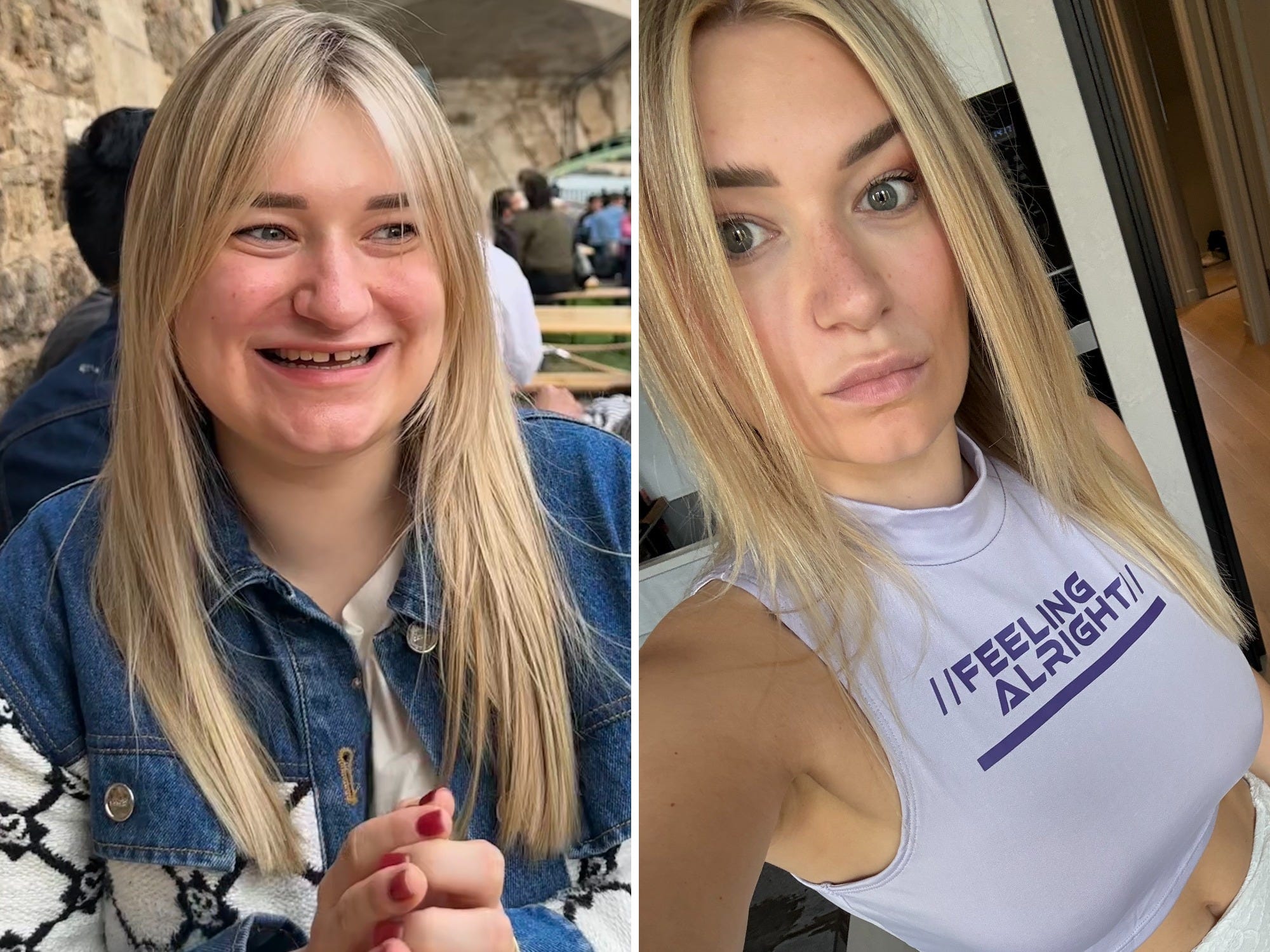 After a break-up, I paid $20K for a glow-up at 28. People on social ...