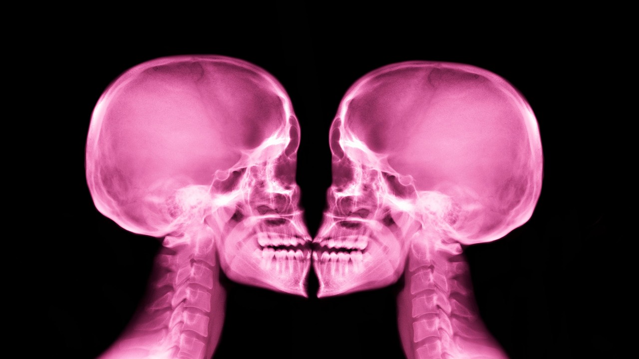 How a relationship betrayal turned into organ failure