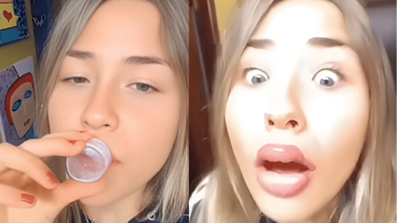 How to get Kylie Jenner-style lips without injections