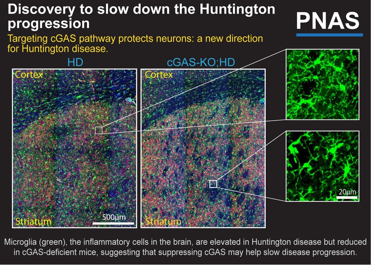 New Huntington target may open simpler drug path to slow brain damage