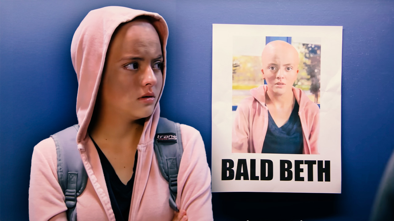 Bald girl humiliated by mean girl?