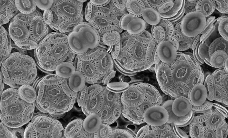 Tiny cells smaller than a hair could decide the fate of Earth’s carbon ...
