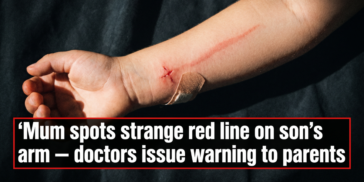Mum spots strange red line on son’s arm — doctors issue warning to parents