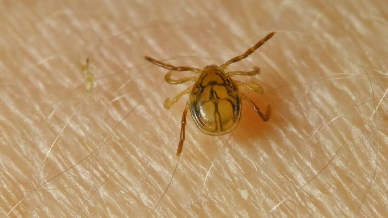 Health officials warn of peak tick season as June begins