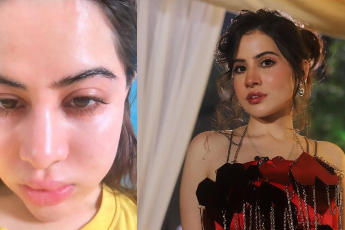 'Koi filler nahi tha': Uorfi Javed reveals what caused her swollen face ...