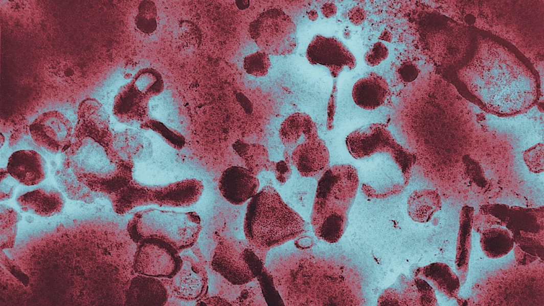 Understanding feline leukemia virus in cats