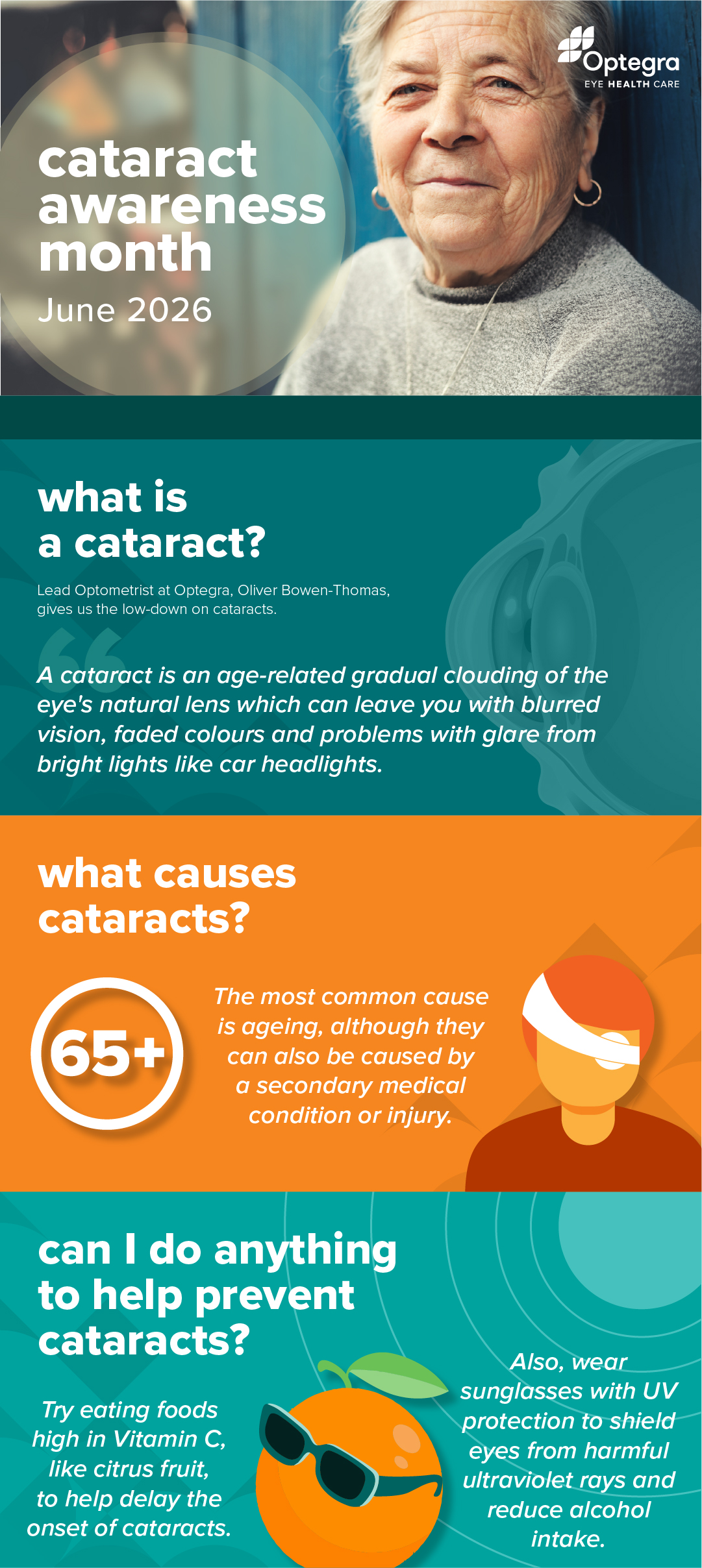 Road safety fears over increase in ageing drivers diagnosed with cataract