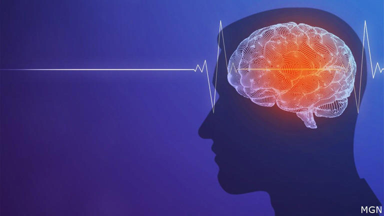 New stroke care guidelines aim to save more lives