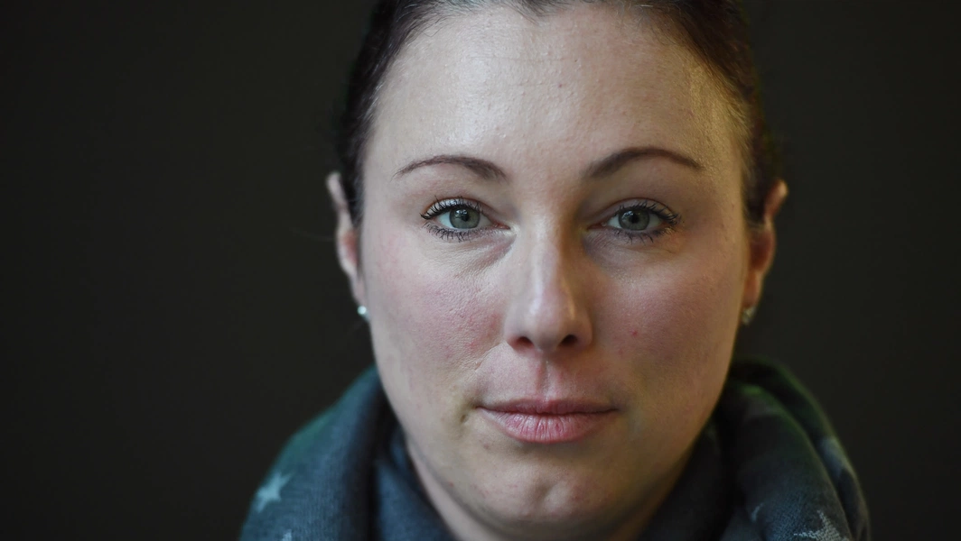Understanding lupus: Causes, symptoms, and advances in treatment