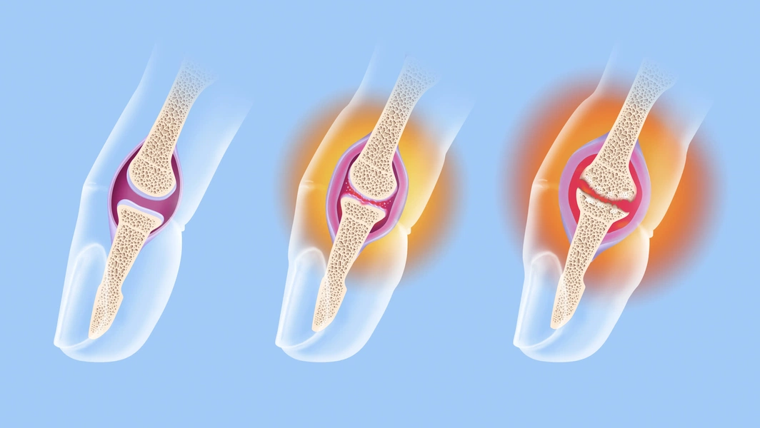 Largest collagen study links supplements to skin and joint gains