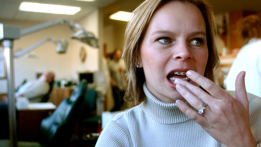 Ceramic braces: Benefits, drawbacks, and comparisons