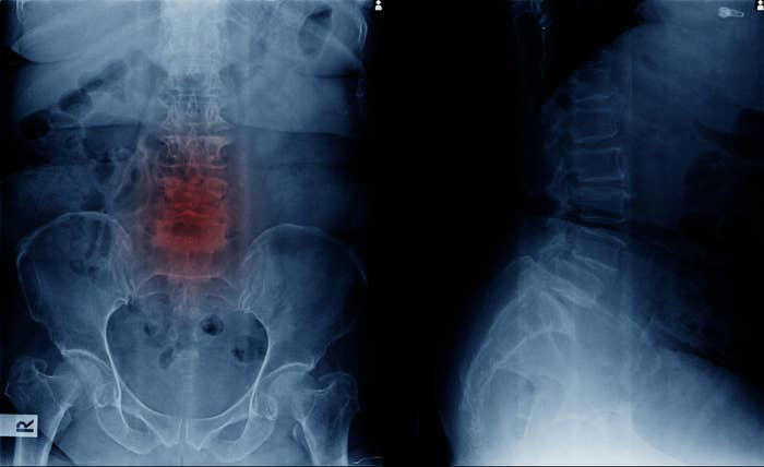 Doctors are begging you to stop doing these exercises for the sake of ...
