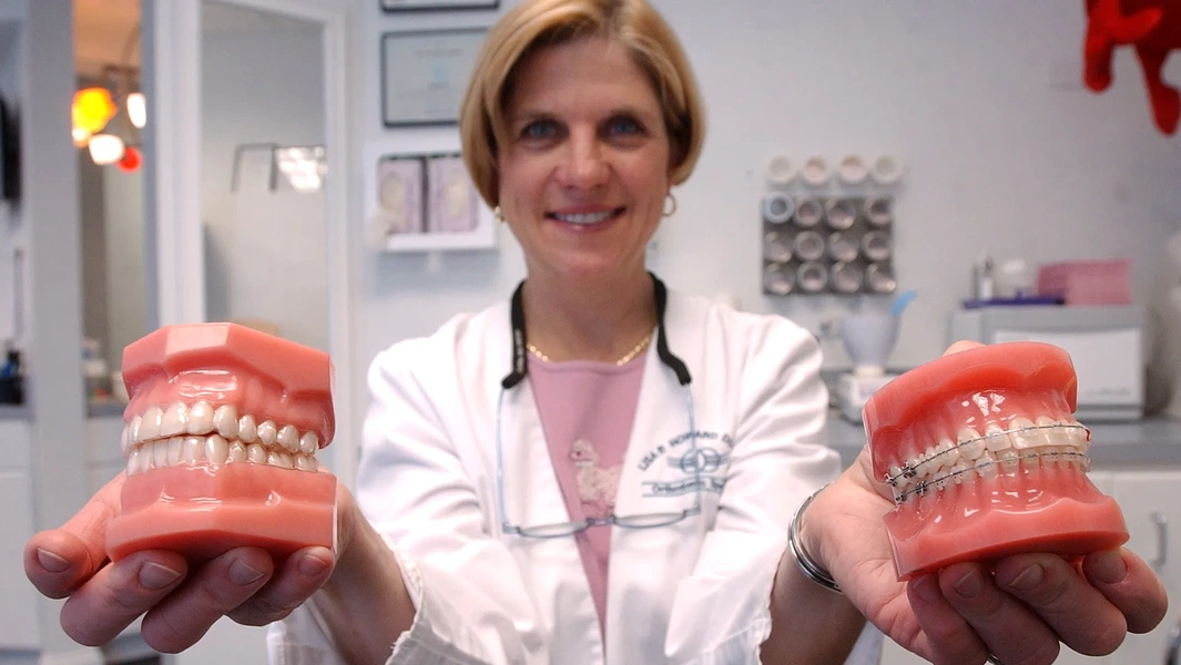 Ceramic braces: Benefits, drawbacks, and comparisons