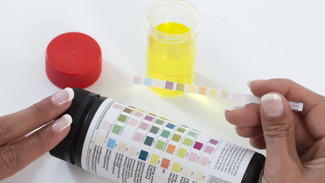 Recognizing early and advanced signs of bladder cancer