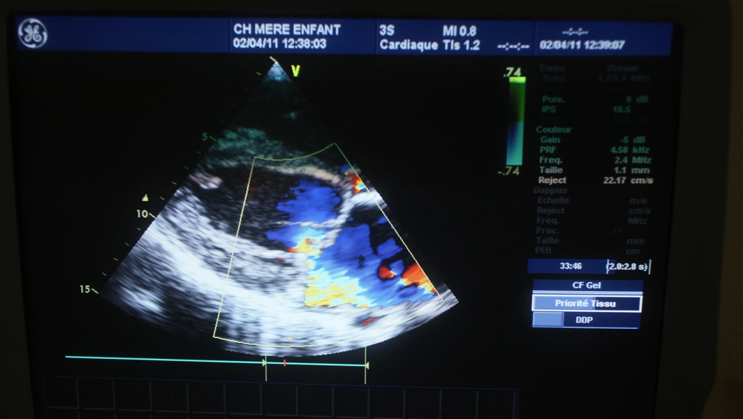 Unexpected ultrasound findings and their impacts
