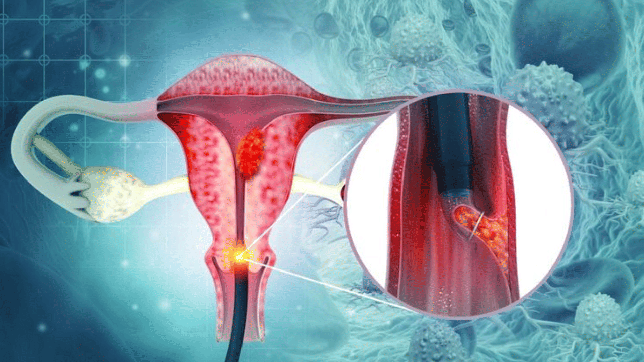 India launches first indigenous HPV test, bringing affordable cervical ...