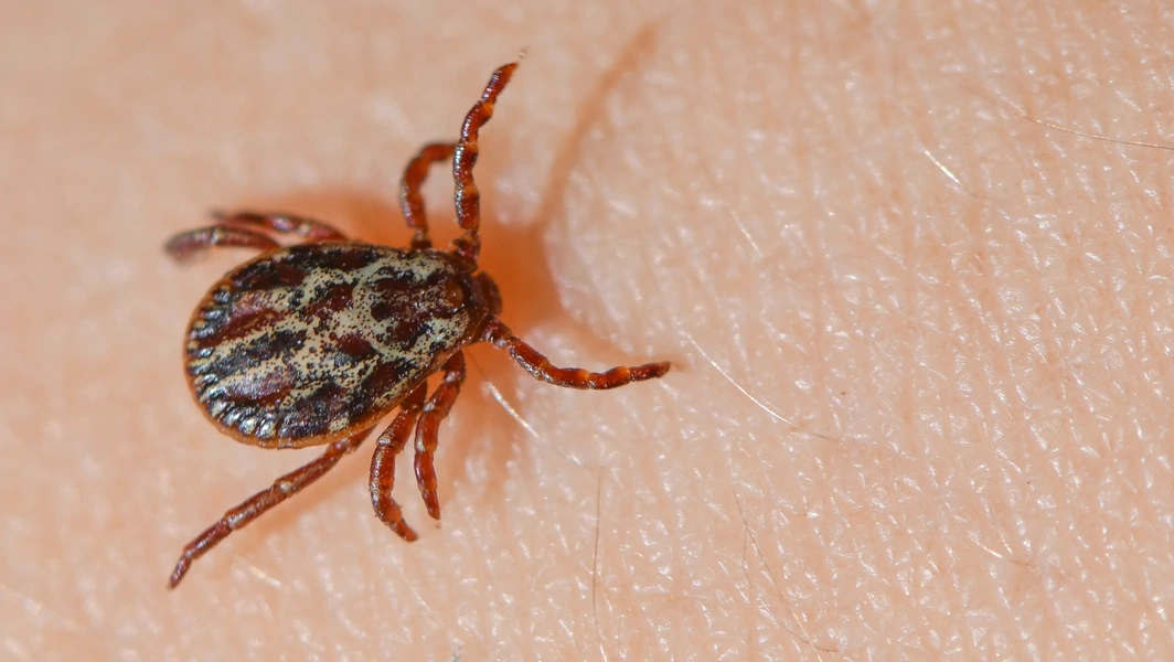 Tick-borne meat allergy cases rise as new treatment emerges