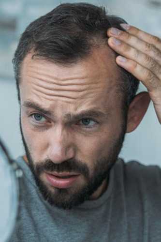 The most effective topical treatments for advanced hair loss