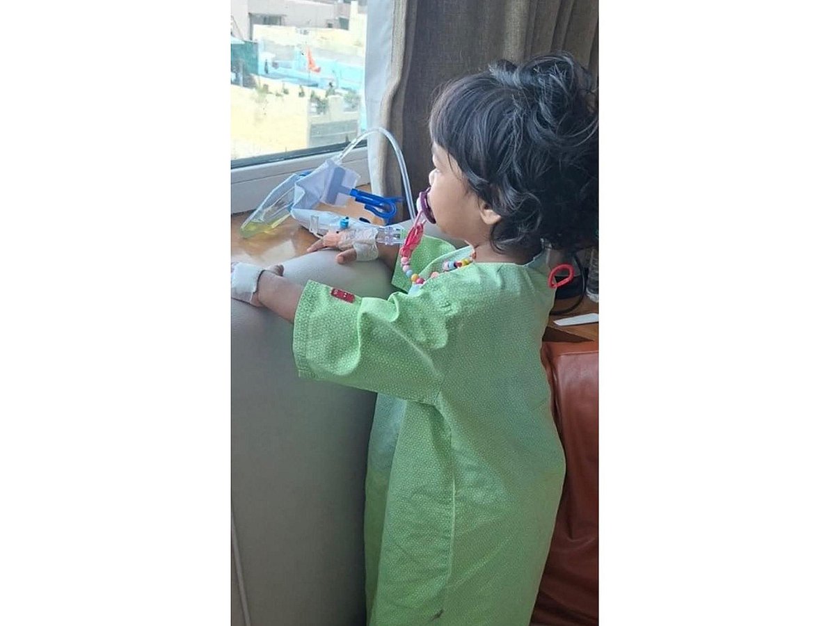 Delhi surgeons carry out complex robotic kidney surgery on infant
