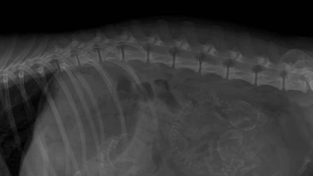 6 unusual objects and organisms found inside bodies