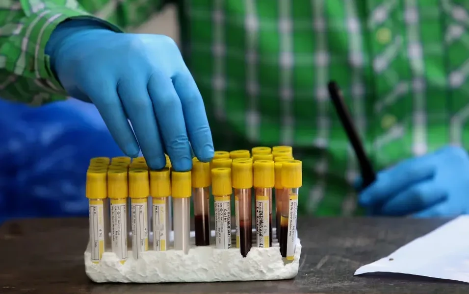 European traveller’s praise spotlights India’s quick medical testing