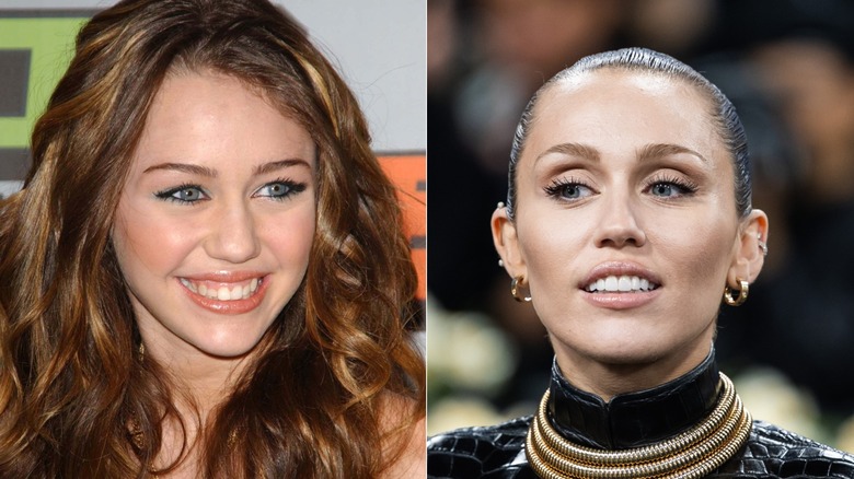 Celebrity smile transformations that were hard to miss