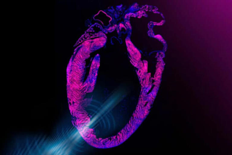 Ce patch autocollant du MIT pourrait remplacer les pacemakers implantés ...