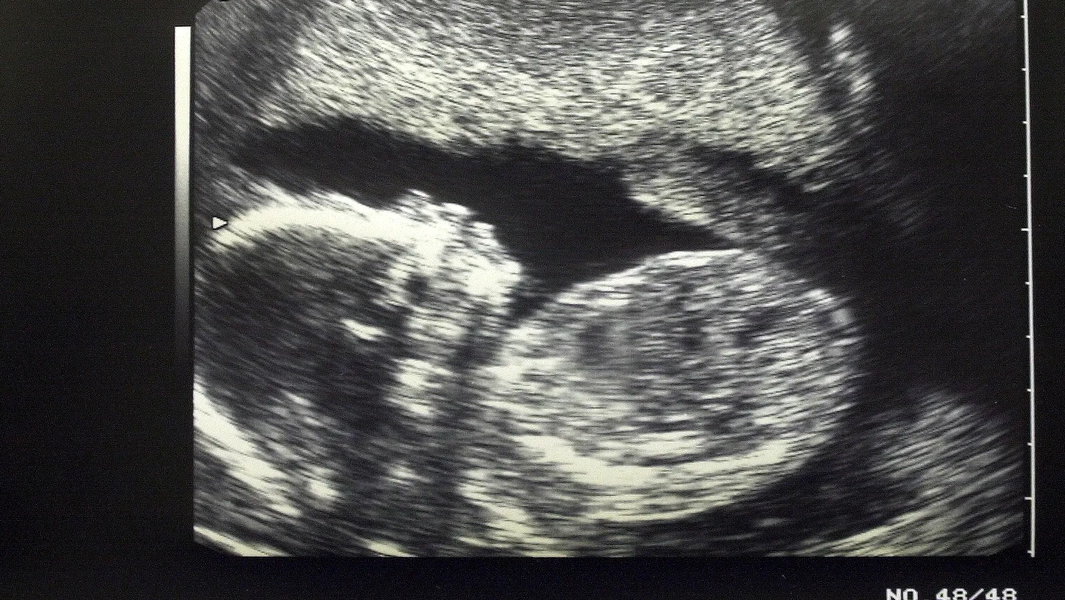 Unexpected ultrasound findings and their impacts