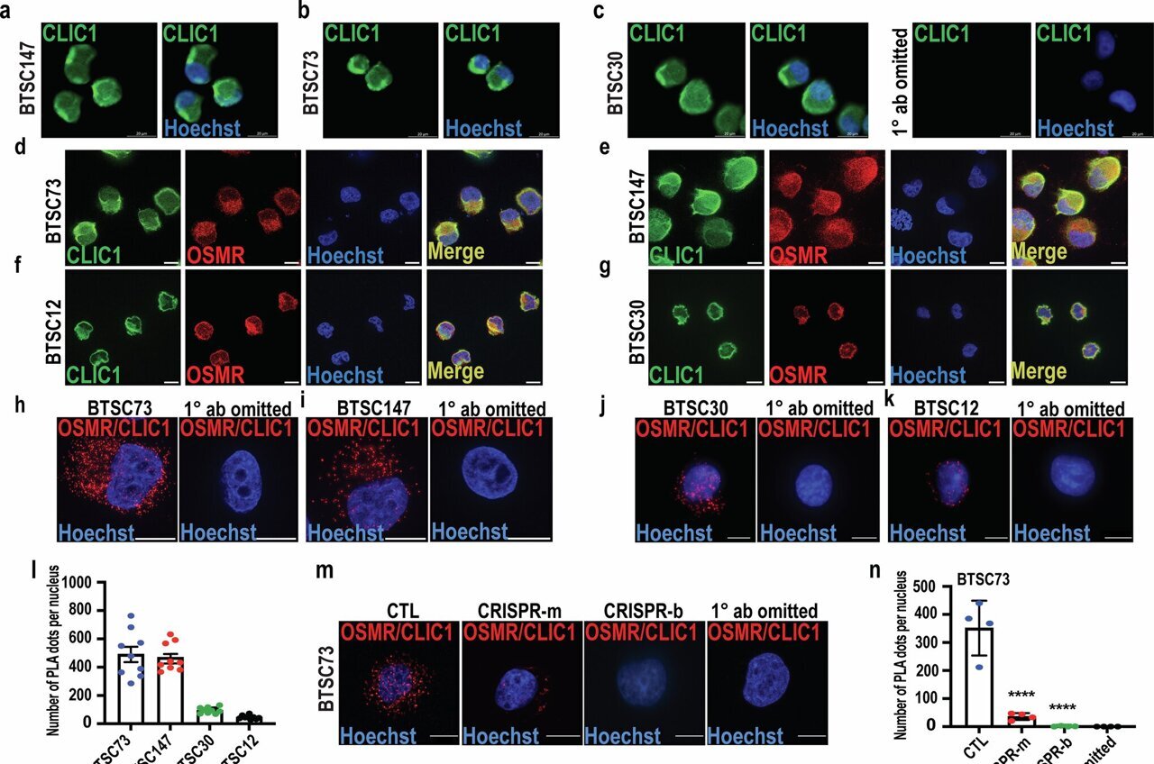 Why glioblastoma keeps beating treatment: Hidden signaling axis could ...