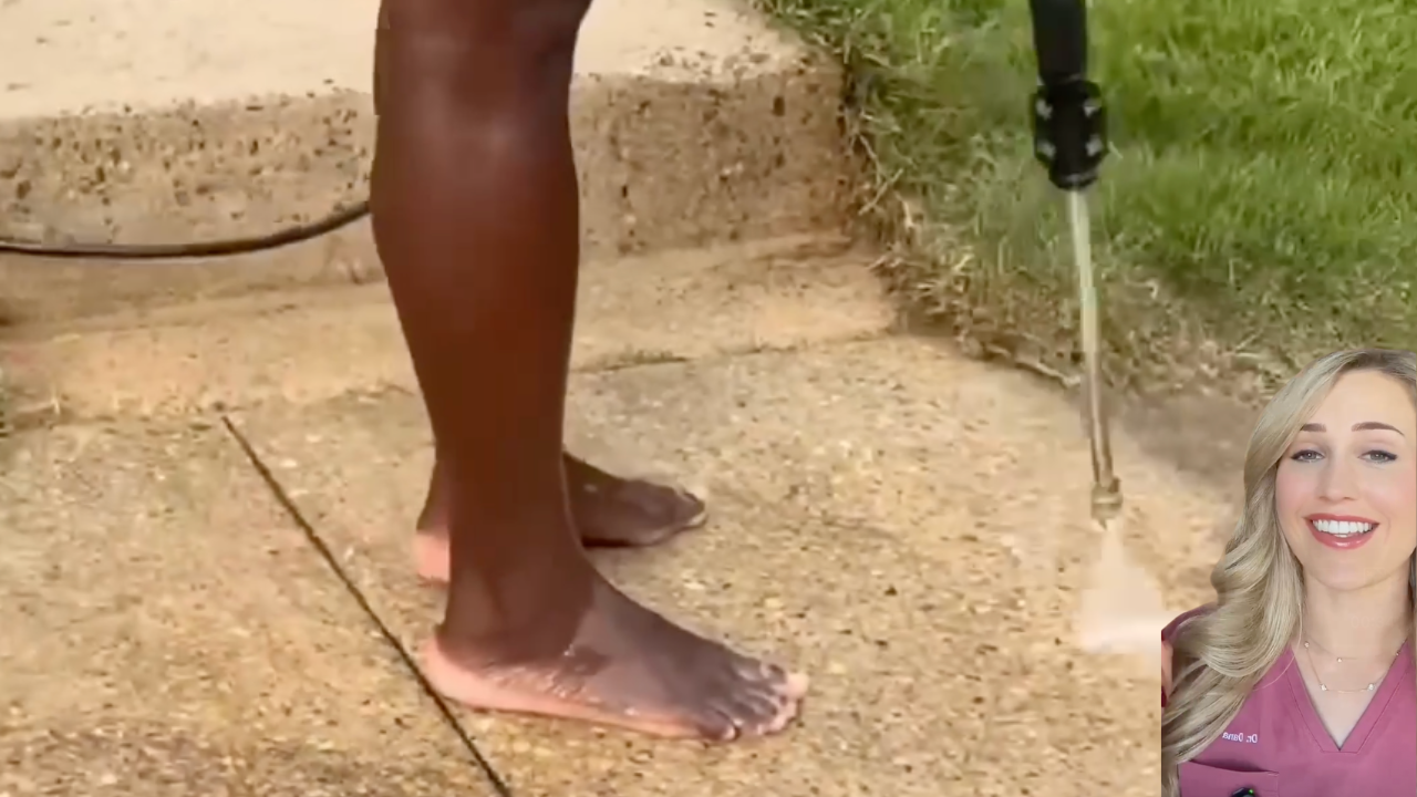 Why hands and feet have less melanin, explained by Dr. Dana Figura