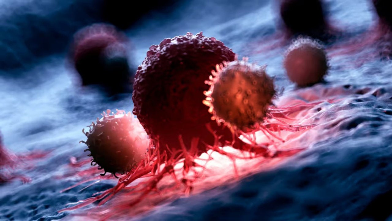 «Para el cáncer la evidencia es inequívoca»: una copa al día eleva el ...