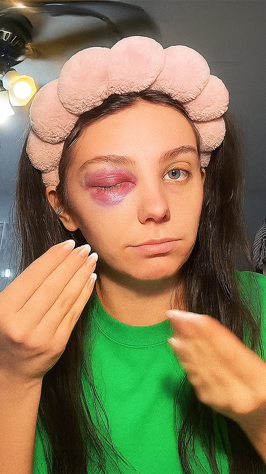 I got punched on Thanksgiving 🙃